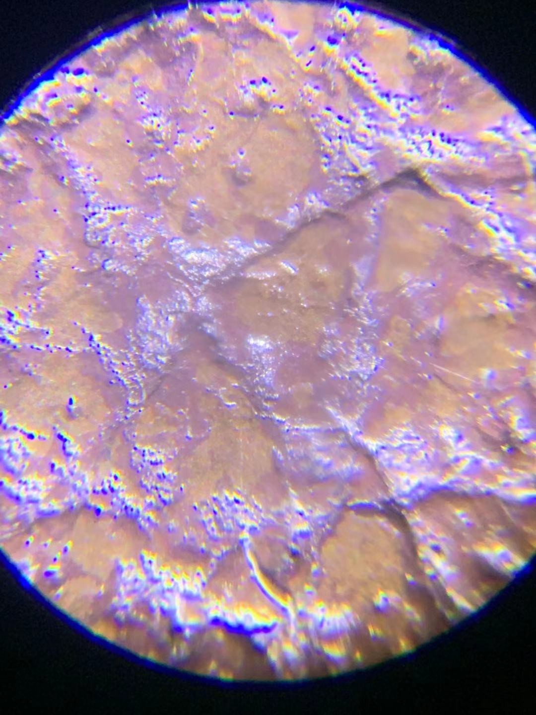 Universal Mobile Phone Microscope